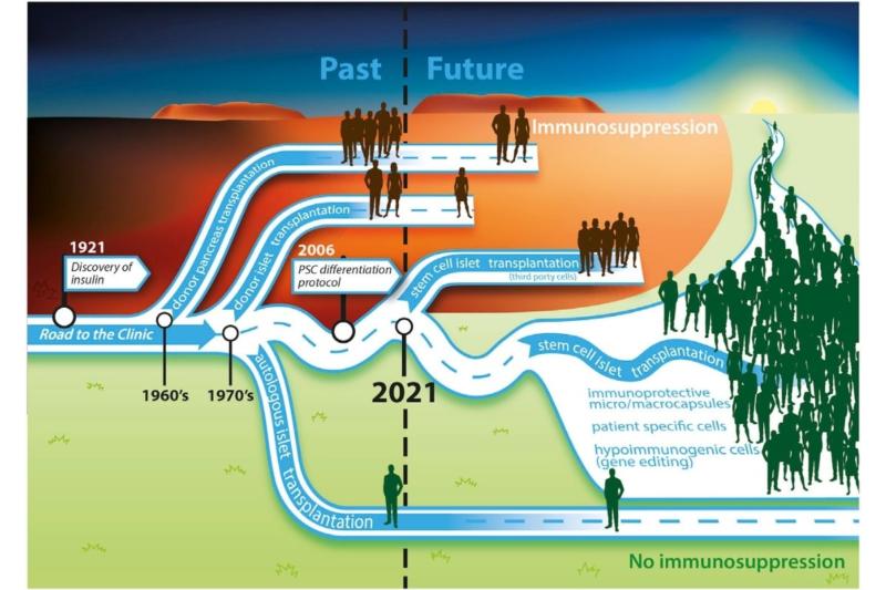 Stem Cell Replacement Therapy: Its Time has Begun - Breakthrough T1D