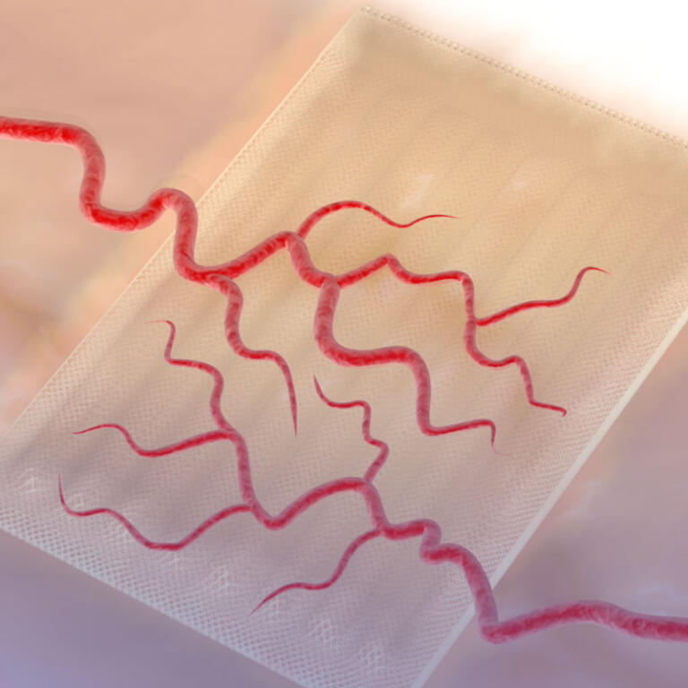 Cell therapies - Breakthrough T1D